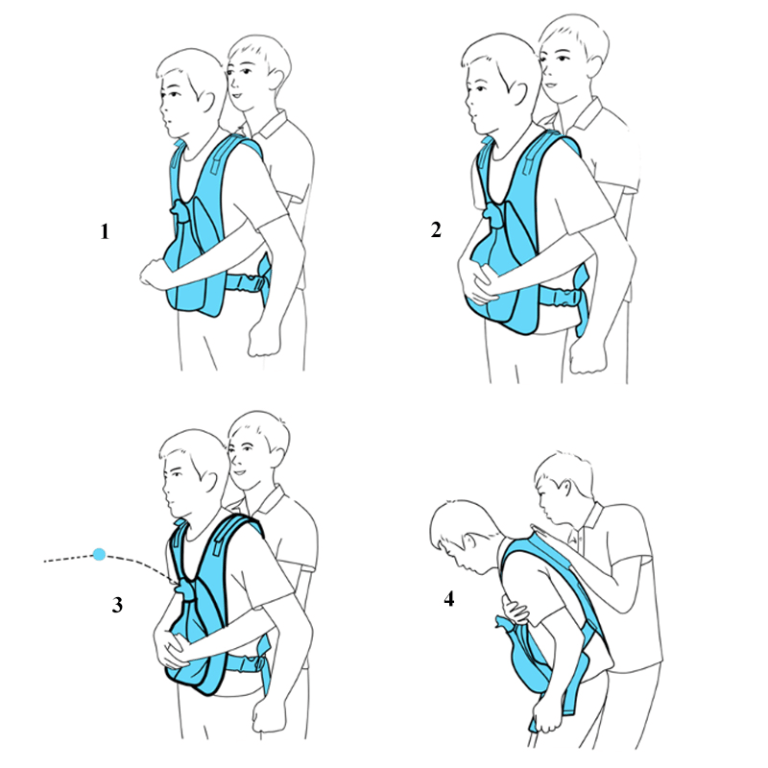 The Evolution of Choking Rescue Training: Meet the Heimlich Vest - Scopelab