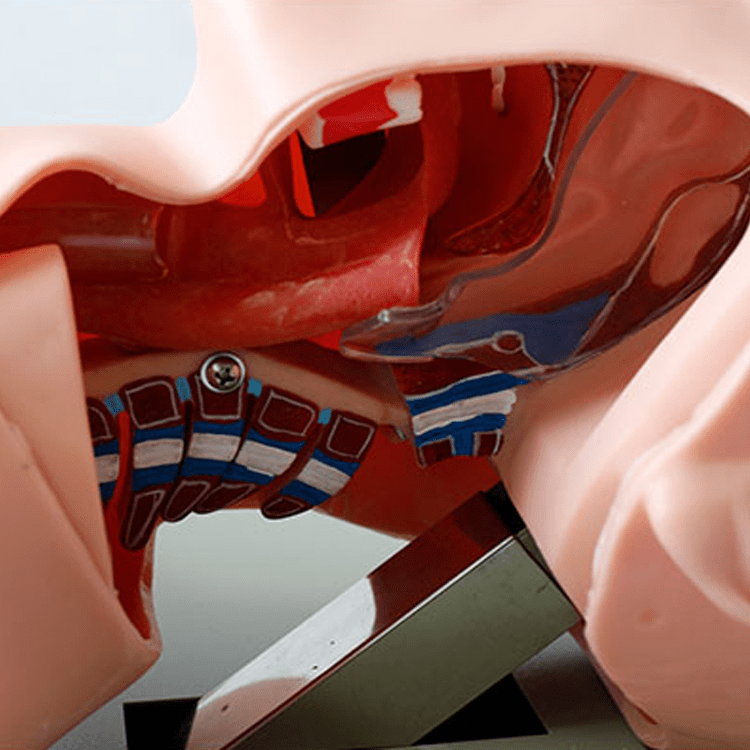 SC-J51 Electronic Airway Intubation Model (with Alarm Device) - Scopelab