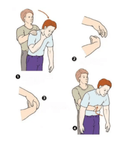 Mastering the Heimlich Maneuver: A Guide to Training and Saving Lives ...