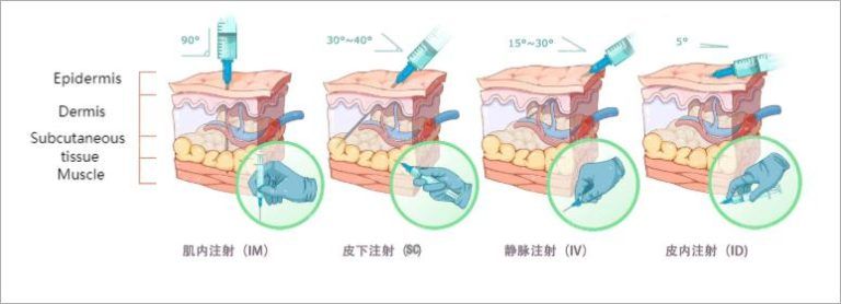From Novice to Expert: A Step-by-Step Cannulation Training for Nurses ...
