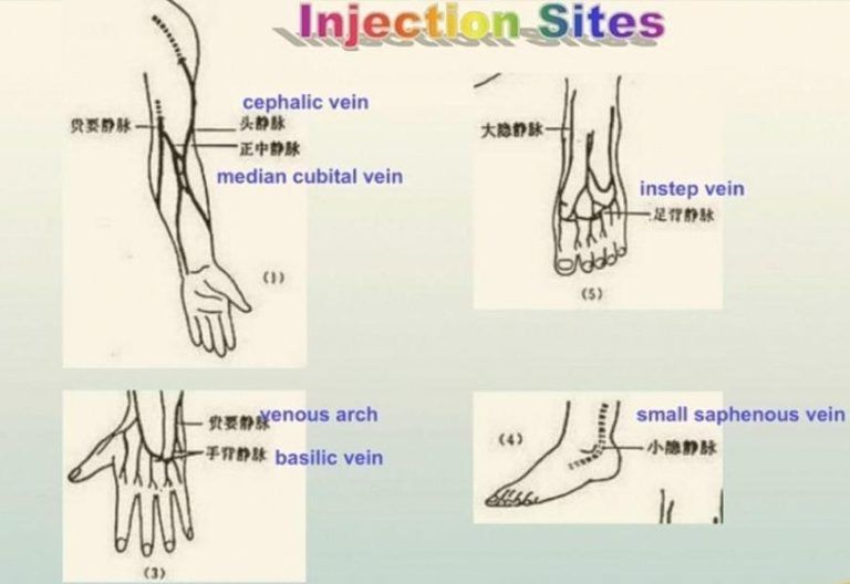 From Novice to Expert: A Step-by-Step Cannulation Training for Nurses ...